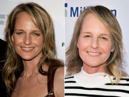 The Truth About The Rumors That Helen Hunt Had Plastic Surgery