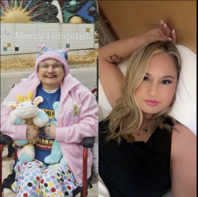 Gypsy Rose Blanchard Shows Off Plastic Surgery Transformation