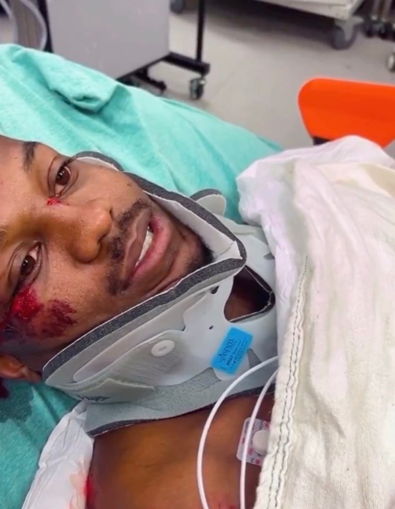 Rapper Hospitalized After Dirt Bike Crash