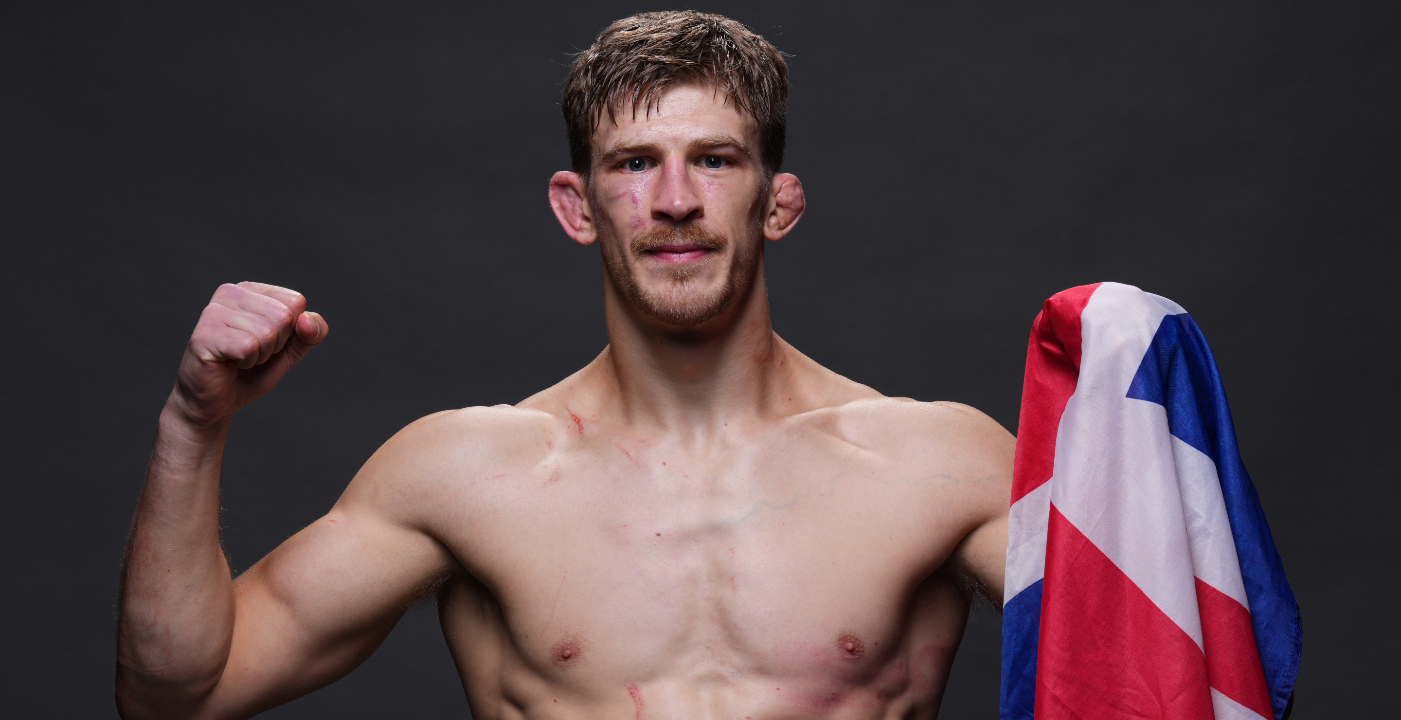 UFC Fighter Attacked On Streets Of Canada: Here's What He Had To Say