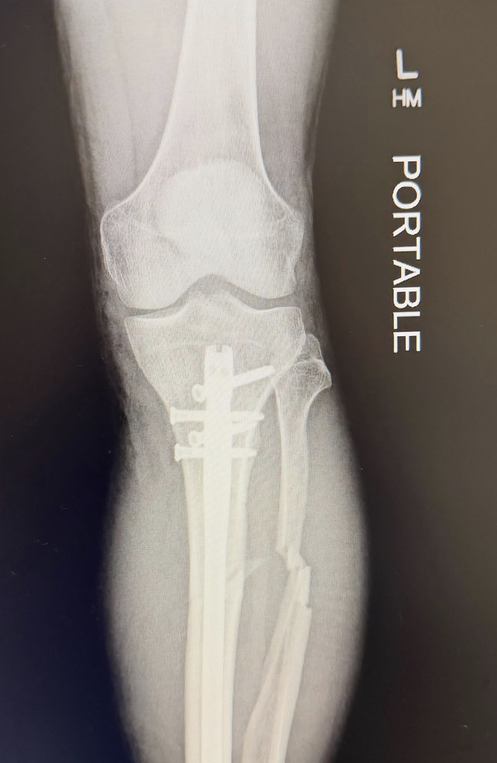 Beloved Music Star Seriously Injured in 'Stupid' Scooter Accident