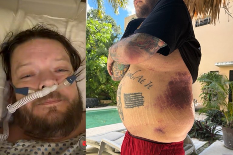 'Pawn Stars' Star Asks Fans For Help with Medical Bills After ...